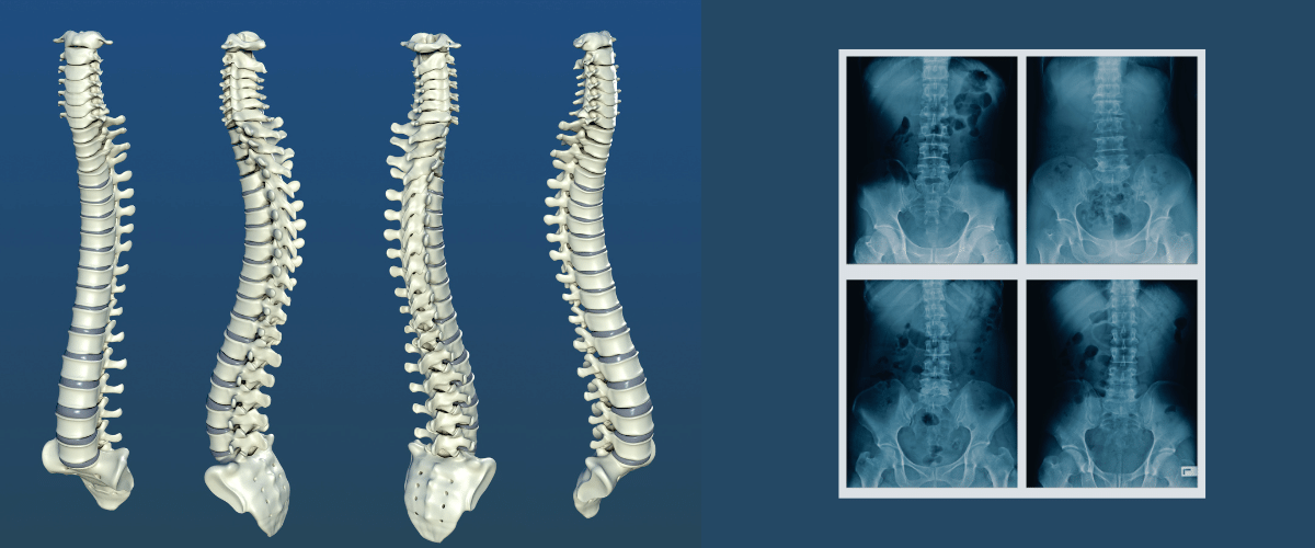 Omurga - Omurganın Şekli - Uzm. Dr. Derya SAYLIK